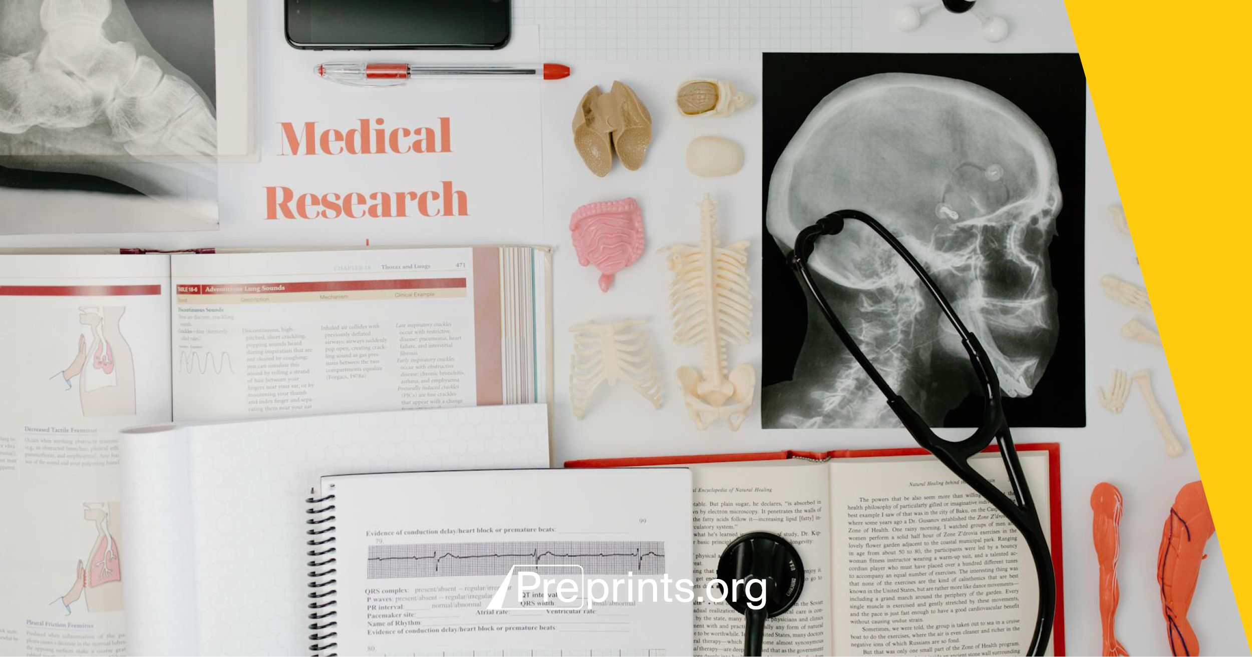 ChatGPT and Cardiovascular Medicine, Challenges and the Future ...